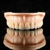 China Aesthetic Zirconia  Dental Bridge High Translucency  CAD CAM Zirconia Crown for sale