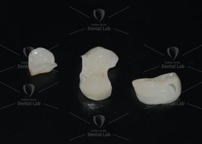 China Biocompatible Lithium Disilicate Pressed Ceramic Inlays with Natural Aesthetics for Minimally-invasive Dental Restoration for sale