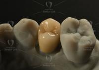 China High-strength Biocompatible Stain-resistant Full Zirconia Dental Crown for All Ceramic Restorations for sale