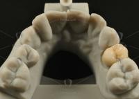 China High-strength Biocompatible Stain-resistant Full Zirconia Dental Crown for All Ceramic Restorations for sale