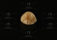 China Custom Metal-free Full-Zirconia Crown and Inlay with High Fracture Resistance and Precise Marginal Fit for sale