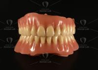 China Full Silicone Dentures Custom-fit According To Oral Impression with Medical-grade Flexible Silicone and Hypoallergenic Design for sale