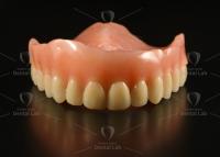 China Full Silicone Dentures Custom-fit According To Oral Impression with Medical-grade Flexible Silicone and Hypoallergenic Design for sale