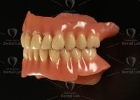 China Full Silicone Dentures Custom-fit According To Oral Impression with Medical-grade Flexible Silicone and Hypoallergenic Design for sale