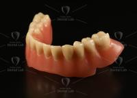 China Full Silicone Dentures Custom-fit According To Oral Impression with Medical-grade Flexible Silicone and Hypoallergenic Design for sale