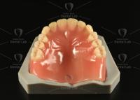 China Full Silicone Dentures Custom-fit According To Oral Impression with Medical-grade Flexible Silicone and Hypoallergenic Design for sale