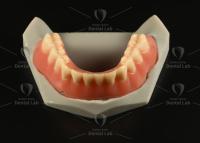 China Full Silicone Dentures Custom-fit According To Oral Impression with Medical-grade Flexible Silicone and Hypoallergenic Design for sale