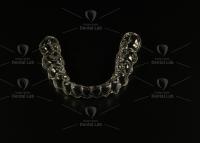 China Custom-made Clear Retainer Virtually Invisible Dental Retainer Made of Medical-grade Thermoplastic for sale