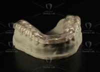 China Custom 3D Printed Hard Occlusal Splint Dental Bite Guard for Bruxism Treatment with Medical-grade Resin and High-precision Fit for sale