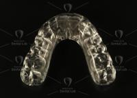 China Custom 3D Printed Hard Occlusal Splint Dental Bite Guard for Bruxism Treatment with Medical-grade Resin and High-precision Fit for sale