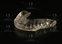 China Custom 3D Printed Hard Occlusal Splint Dental Bite Guard for Bruxism Treatment with Medical-grade Resin and High-precision Fit for sale