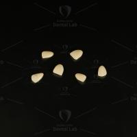China EMAX Lithium Disilicate Veneers Natural Aesthetic China Dental Lab for sale