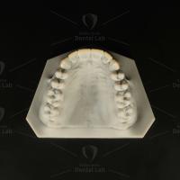 China EMAX Lithium Disilicate Veneers Natural Aesthetic China Dental Lab for sale