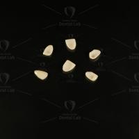 China EMAX Lithium Disilicate Veneers Natural Aesthetic China Dental Lab for sale