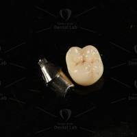 China Cement Retained Zirconia Implant Crown And Bridge CAD/CAM Dental Lab for sale