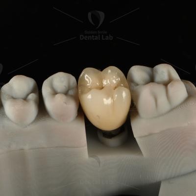 China Cement Retained Zirconia Implant Crown And Bridge CAD/CAM Dental Lab for sale