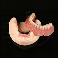 China Custom CAD CAM Titanium Dental Implant Bar Overdenture With Artificial Teeth for sale