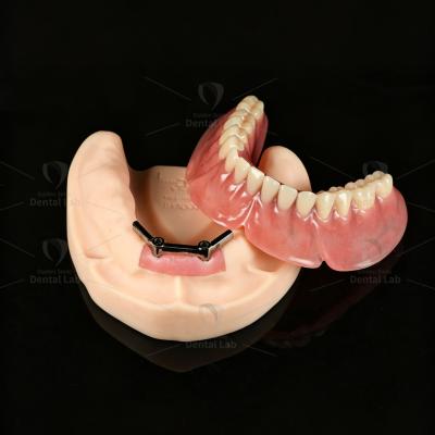 China Custom CAD CAM Titanium Dental Implant Bar Overdenture With Artificial Teeth for sale