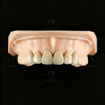 China Co-Cr Alloy PFM Crown & Bridge  China Dental Lab for sale