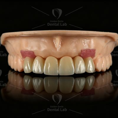 China Multilayered Full Zirconia Screw-Retained Bridge, Customizable, for Anterior Implant Restoration for sale