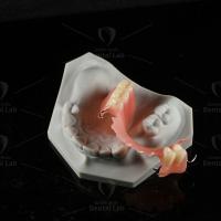 China CAD/CAM Removable Partial Denture for sale
