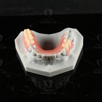 China CAD/CAM Removable Partial Denture for sale