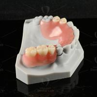 China CAD/CAM Removable Partial Denture for sale