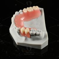 China CAD/CAM Removable Partial Denture for sale