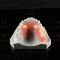 China China Dental Lab Silicone Removable Partial Denture with Y-Clasp & Wire Clasp for sale