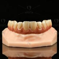 China One-piece Integral Zirconia Malo Bridge Pure Titanium Framework for sale