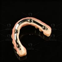 China One-piece Integral Zirconia Malo Bridge Pure Titanium Framework for sale