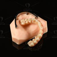 China One-piece Integral Zirconia Malo Bridge Pure Titanium Framework for sale