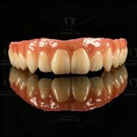 China One-piece Integral Zirconia Malo Bridge Pure Titanium Framework for sale