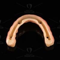 China One-piece Integral Zirconia Malo Bridge Pure Titanium Framework for sale