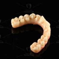 China One-piece Integral Zirconia Malo Bridge Pure Titanium Framework for sale