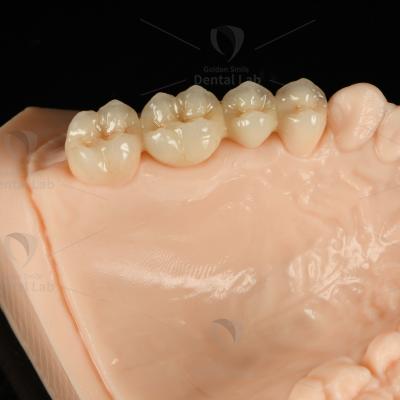 China CAD/CAM Dental Zirconia Crown & Bridge,  Zirconia Restoration for sale