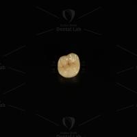 China China Dental Lab Full Zirconia Crown | All Ceramic Dental Restoration for sale