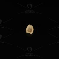 China China Dental Lab Full Zirconia Crown | All Ceramic Dental Restoration for sale