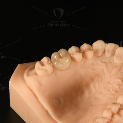 China China Dental Lab Full Zirconia Crown | All Ceramic Dental Restoration for sale