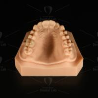 China China Dental Lab Full Zirconia Crown | All Ceramic Dental Restoration for sale