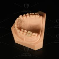China China Dental Lab Full Zirconia Crown | All Ceramic Dental Restoration for sale