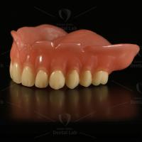 China Complete Edentulous Denture | Full Arch Removable Denture for sale