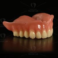 China Complete Edentulous Denture | Full Arch Removable Denture for sale
