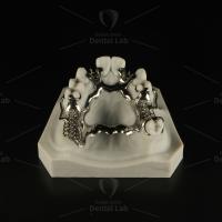 China Custom Ultra-Thin Biocompatible Dental Metal Framework for Removable Partial Denture and Metal Partial Denture Restoration for sale