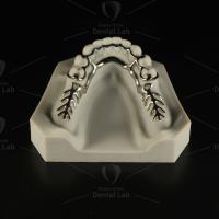 China Custom Ultra-Thin Biocompatible Dental Metal Framework for Removable Partial Denture and Metal Partial Denture Restoration for sale