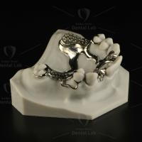 China Custom Ultra-Thin Biocompatible Dental Metal Framework for Removable Partial Denture and Metal Partial Denture Restoration for sale