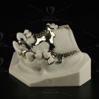 China Custom Ultra-Thin Biocompatible Dental Metal Framework for Removable Partial Denture and Metal Partial Denture Restoration for sale