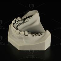 China Custom Ultra-Thin Biocompatible Dental Metal Framework for Removable Partial Denture and Metal Partial Denture Restoration for sale