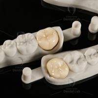 China Multilayer Zirconia Full Ceramic Crown Customizable Zirconia Restorations for sale