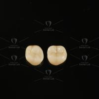 China Multilayer Zirconia Full Ceramic Crown Customizable Zirconia Restorations for sale